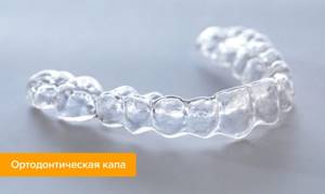Cтоматологическая детская капа для зубов для исправления прикуса